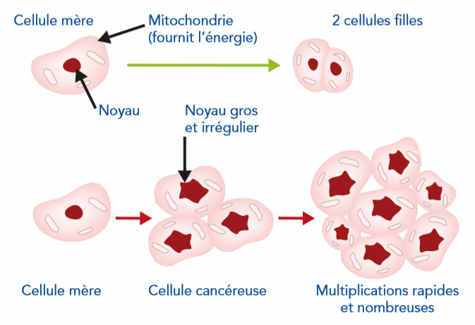 Qu'est-ce qu'un cancer